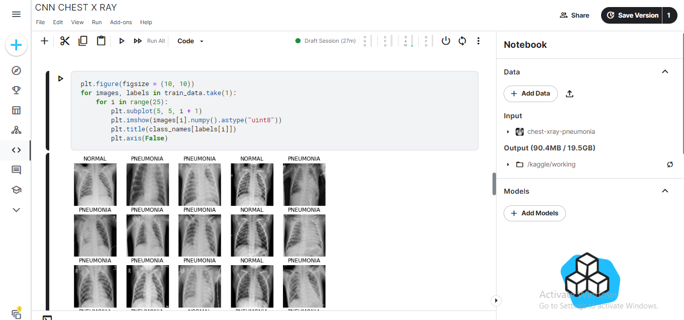 GitHub - rajeshsingh123/Chest-X-ray-Classification-