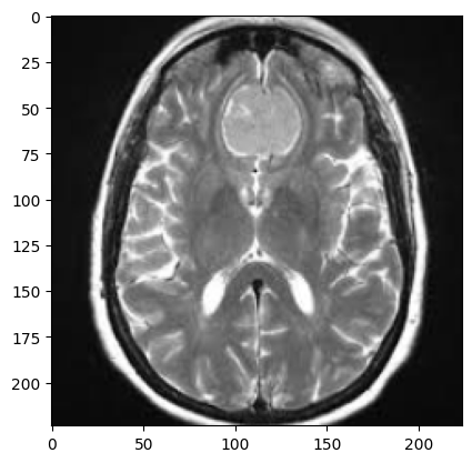 GitHub - Samuel-Mbah/Brain-Tumour-Detection: Will utilise convolutional ...