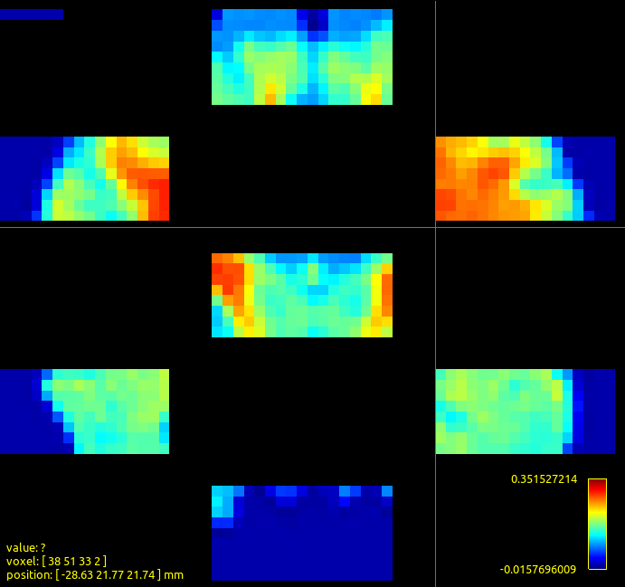 linear interpolation introduces bright edge? · Issue #1681 · MRtrix3/mrtrix3 · GitHub