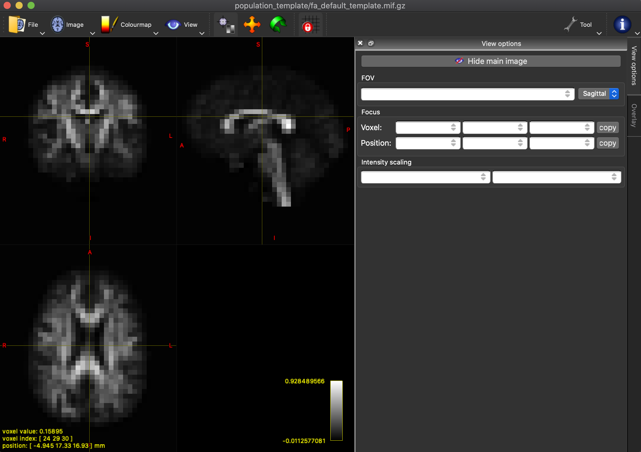 mrview: dark mode issues · Issue #1864 · MRtrix3/mrtrix3 · GitHub