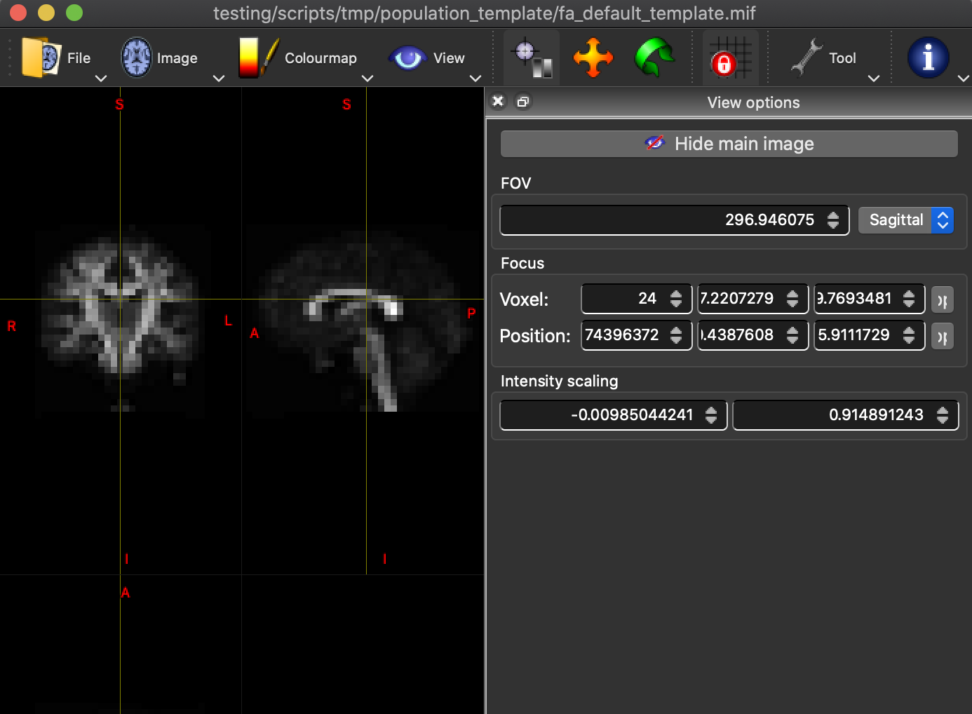 mrview: dark mode issues · Issue #1864 · MRtrix3/mrtrix3 · GitHub