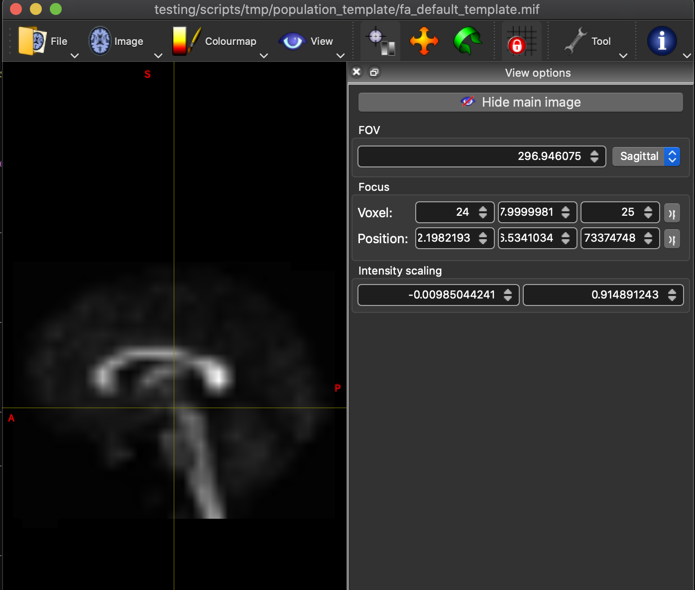 mrview: dark mode issues · Issue #1864 · MRtrix3/mrtrix3 · GitHub