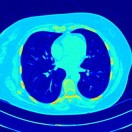 Github Goonermh99 Lung Cancer Detection System