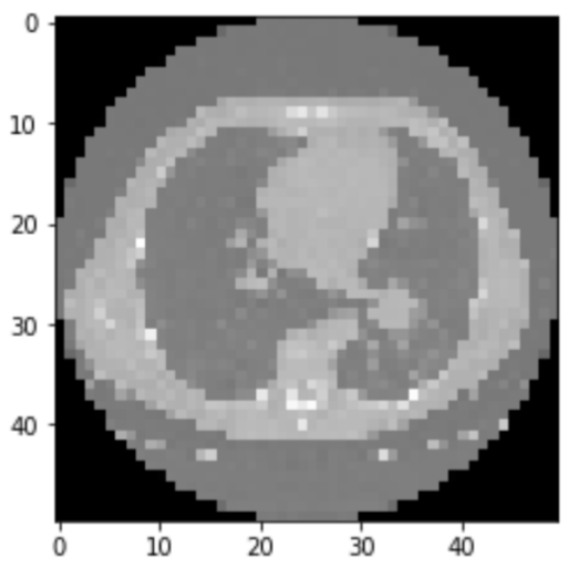 Github Goonermh99 Lung Cancer Detection System