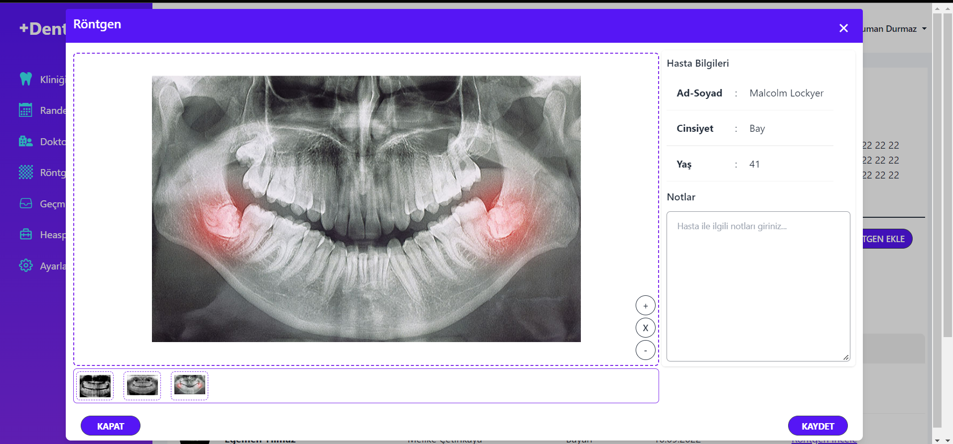 Rontgen Popup Add · Issue #35 · Stock-Management-System/dentalApp · GitHub
