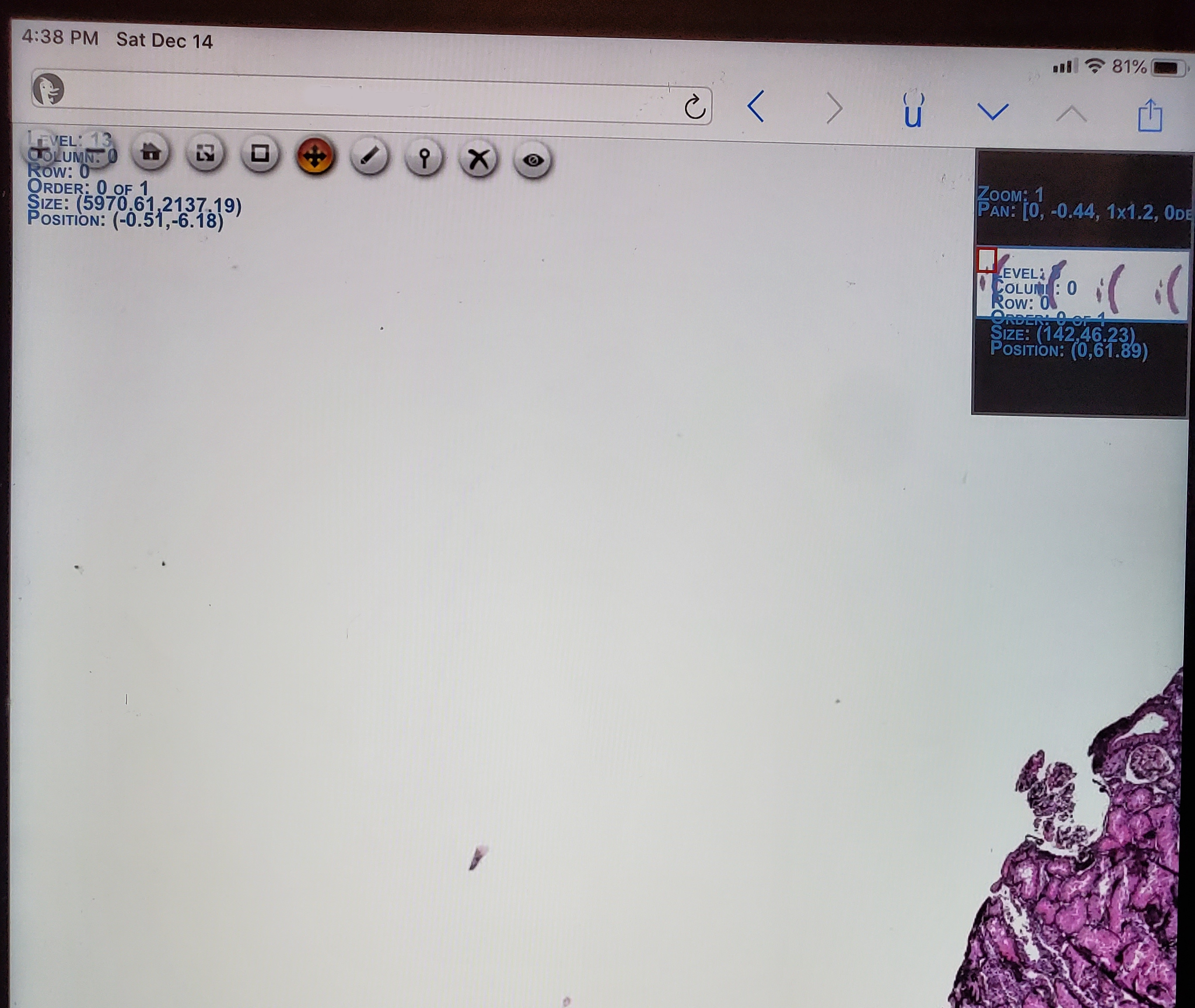 openseadragon viewer goes blank on iPad when zooming in DZI images · Issue #1751 · openseadragon ...