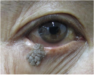 GitHub - Arwa-Fawzy/Vision-Guard-for-Eye-Cancer-Detection: Vision Guard ...