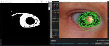 GitHub - Arwa-Fawzy/Vision-Guard-for-Eye-Cancer-Detection: Vision Guard App: A Machine Learning ...