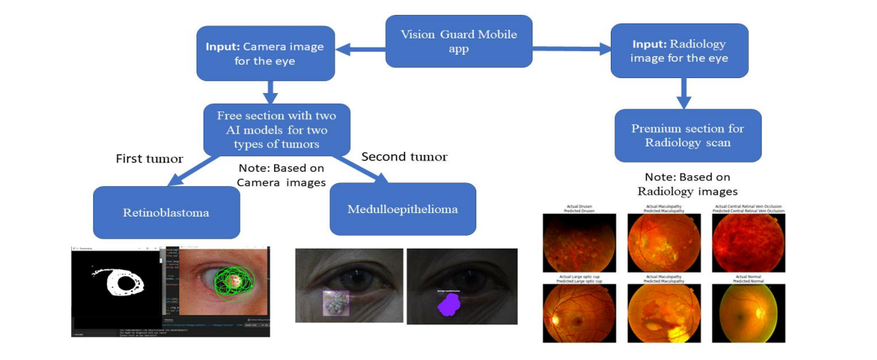 GitHub - Arwa-Fawzy/Vision-Guard-for-Eye-Cancer-Detection: Vision Guard ...