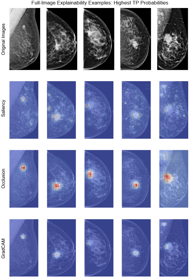 GitHub - karla-sam/Deep-Learning-Explainability-for-Breast-Cancer ...