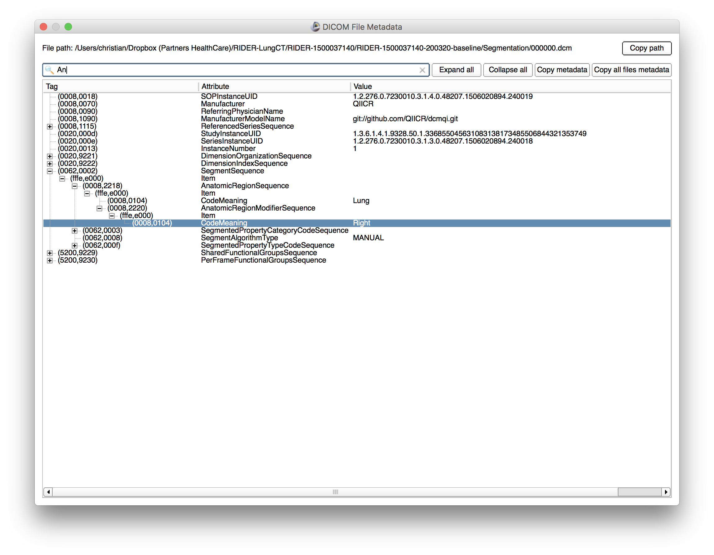 Anatomic Region Modifier is not displayed in terminology tooltip ...