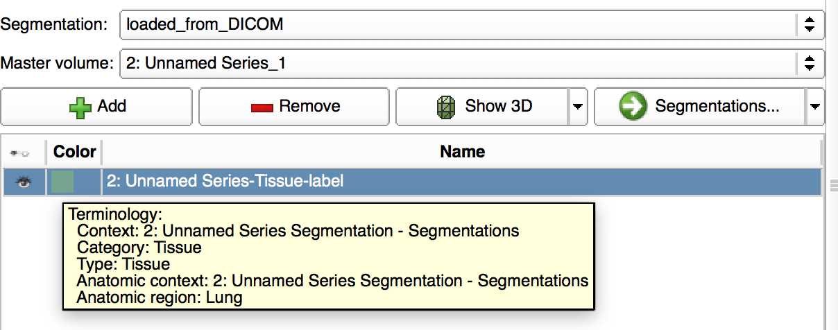 Anatomic Region Modifier is not displayed in terminology tooltip ...