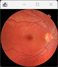 GitHub - Michelangelo-Foresta/Multi-Label-Fundus-Image-Classification