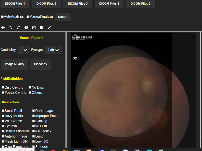 image draw overlaying issues · Issue #96 · ivmartel/dwv-jqmobile · GitHub