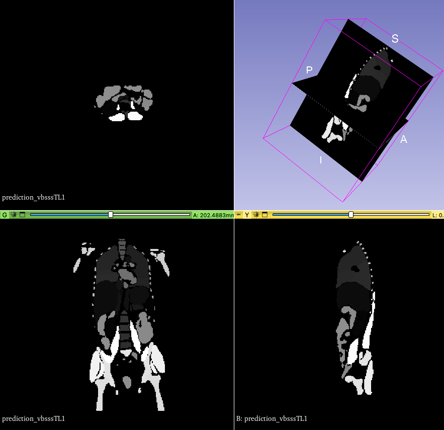 Why the `roi_subset` parameter is not working? · Issue #189 · wasserth/TotalSegmentator · GitHub