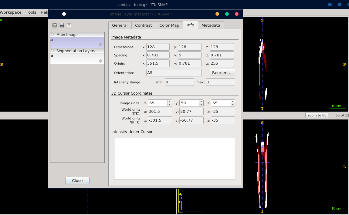 fix: Evaluation on CTPelvic1k-Abdomen, Cervix · Issue #4 · naamiinepal/xrayto3D-benchmark · GitHub