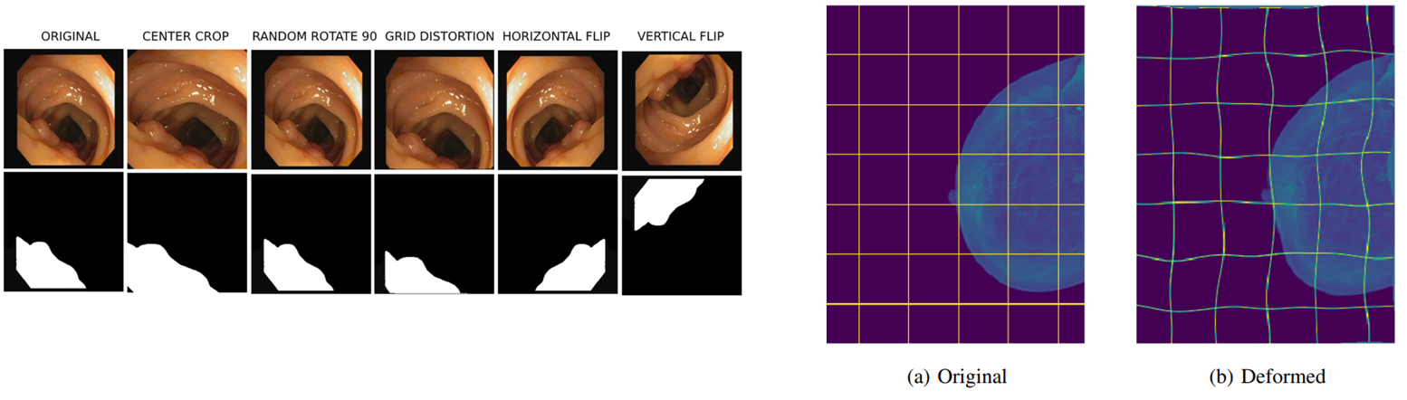 GitHub - Jungseunggi/U-Net_Review
