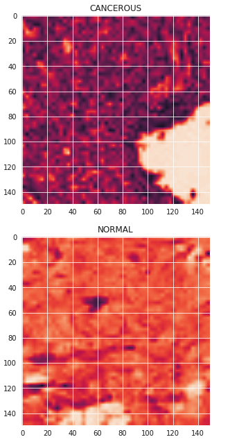 GitHub - BryanKeating/Capstone_CNN_Cancer_Image_Classification