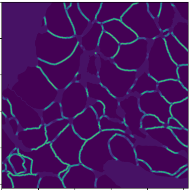 Weight map in crossentropy loss · Issue #1274 · MIC-DKFZ/nnUNet · GitHub