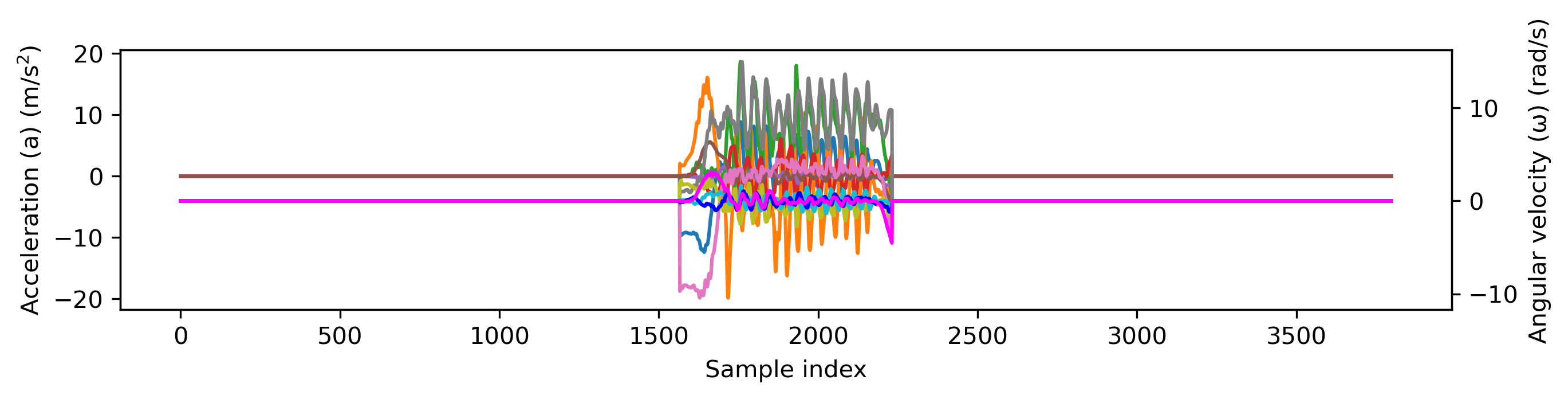 GitHub - RobinChu9890/MTL-U-Net-for-Functional-Shoulder-STS