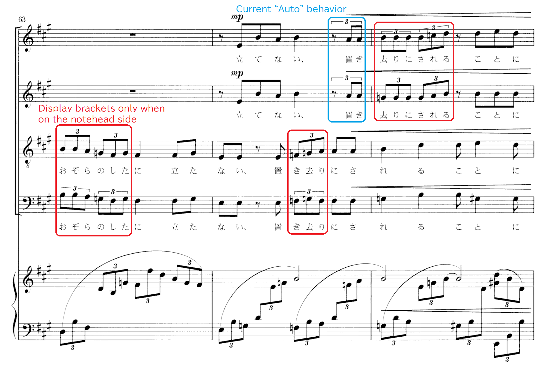 Smarter tuplet bracketing · Issue #17852 · musescore/MuseScore · GitHub