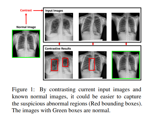 GitHub - ruizhiwong/x-ray-report-generation