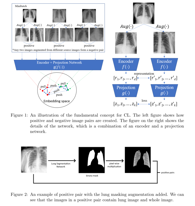 GitHub - renieWong/x-ray-report-generation