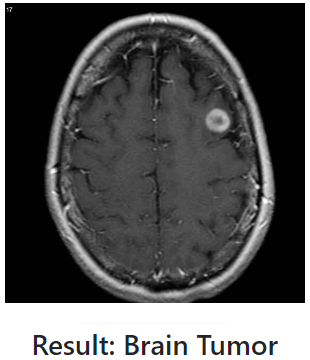 GitHub - Thanasis-Altoglou/Master_Thesis_Brain_Tumor_Classification
