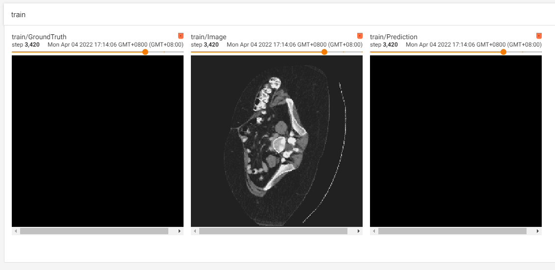 Tensorboard ，the Image Cannot Be Displayed Correctly · Issue 55 · Hucaofightingswin Unet · Github