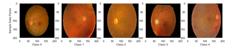 Github Mario21snowblindness Detection Blindness Detection Diabetic Retinopathy Using Deep 