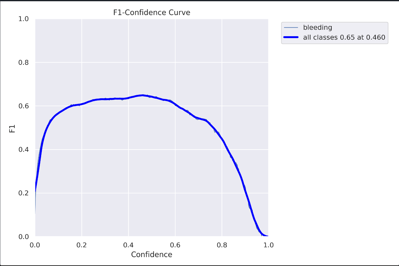 GitHub - Hotragn/AutoWCEBleedGen-Challenge: This repository consists of training, output ...