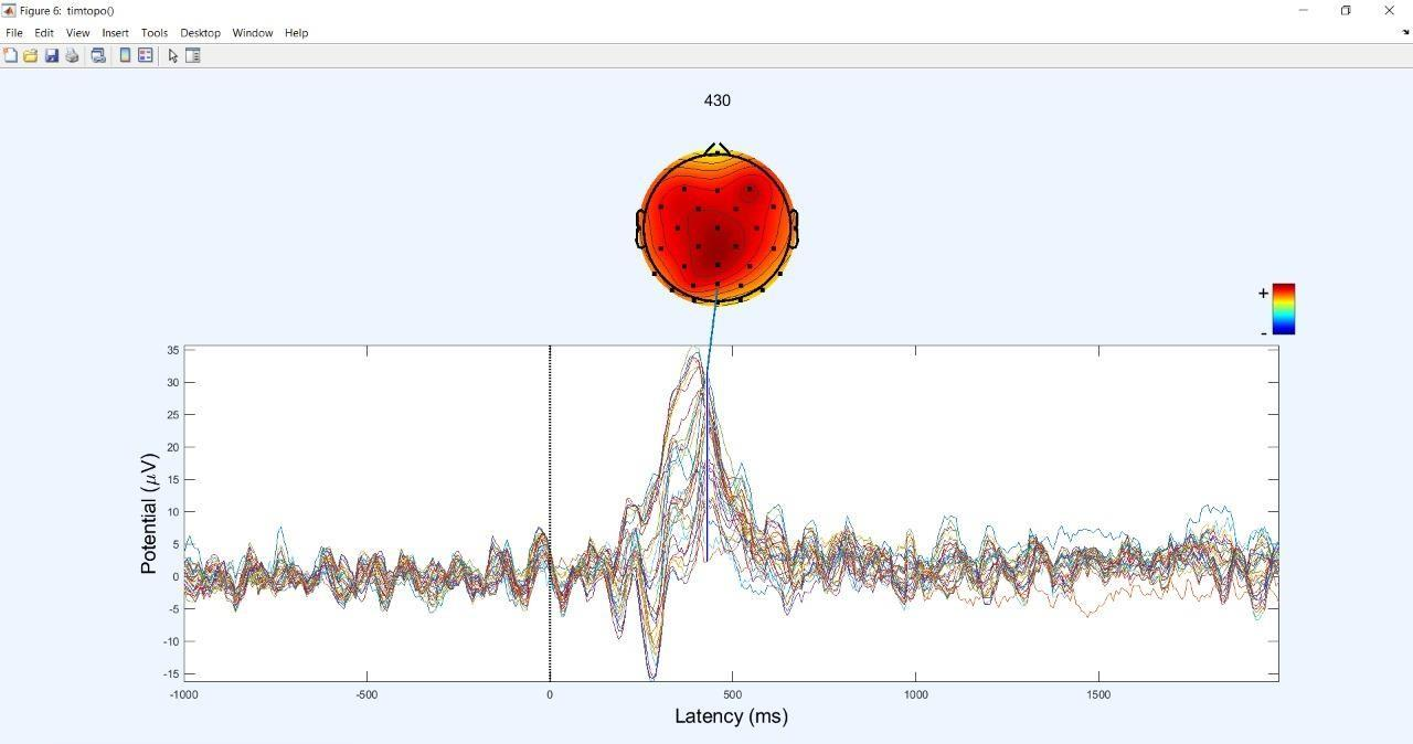 GitHub - Mujeeb-Javed/Quantitative_Analysis_of_EEG