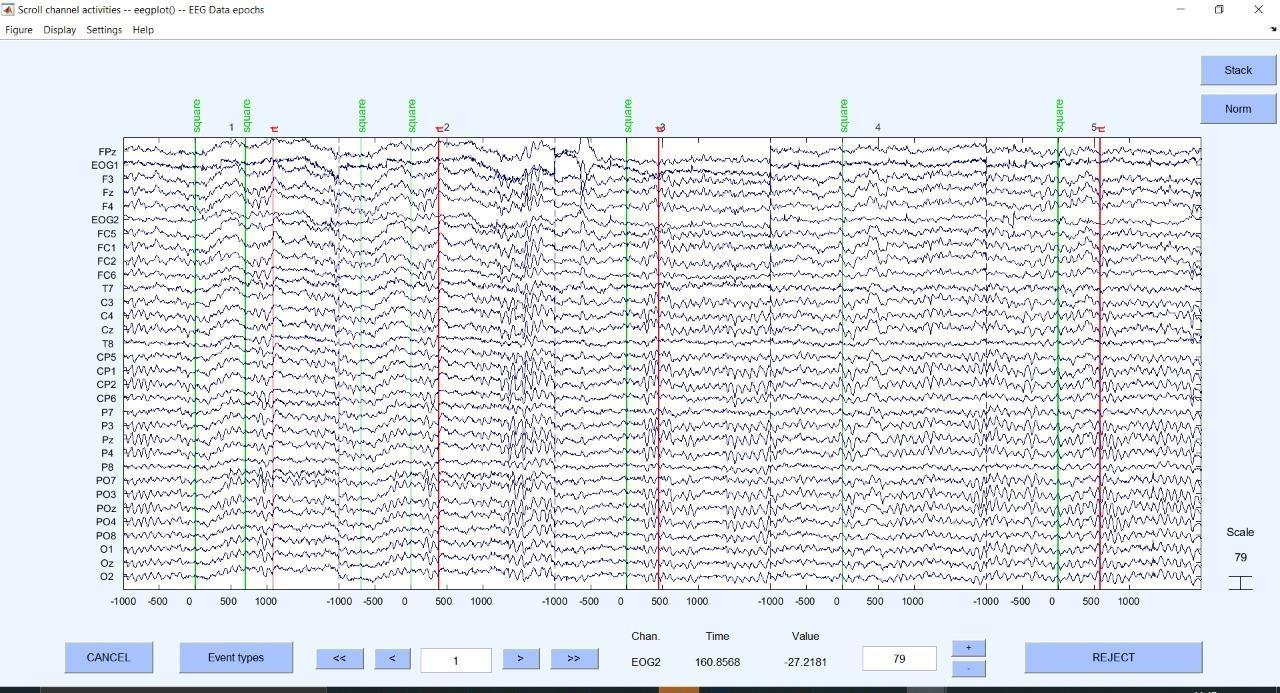 GitHub - Mujeeb-Javed/Quantitative_Analysis_of_EEG