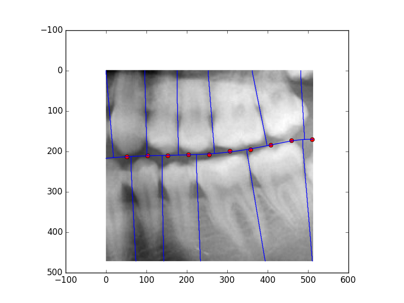 GitHub - uladkasach/tooth-segmentation