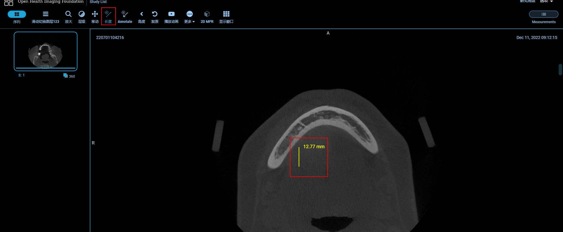 How does niivue perform measurement functions, similar to punctuation ...