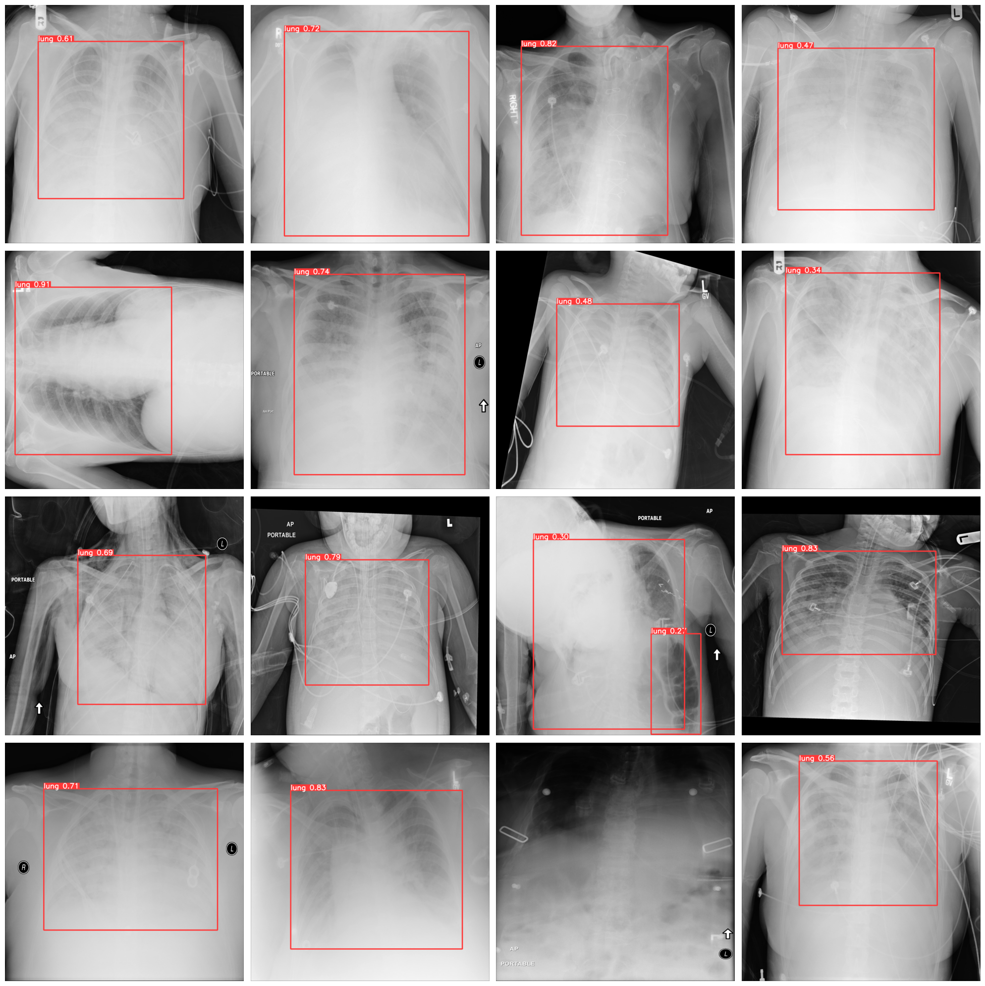 Github Jiseokseo Yolov5 Lung Detection