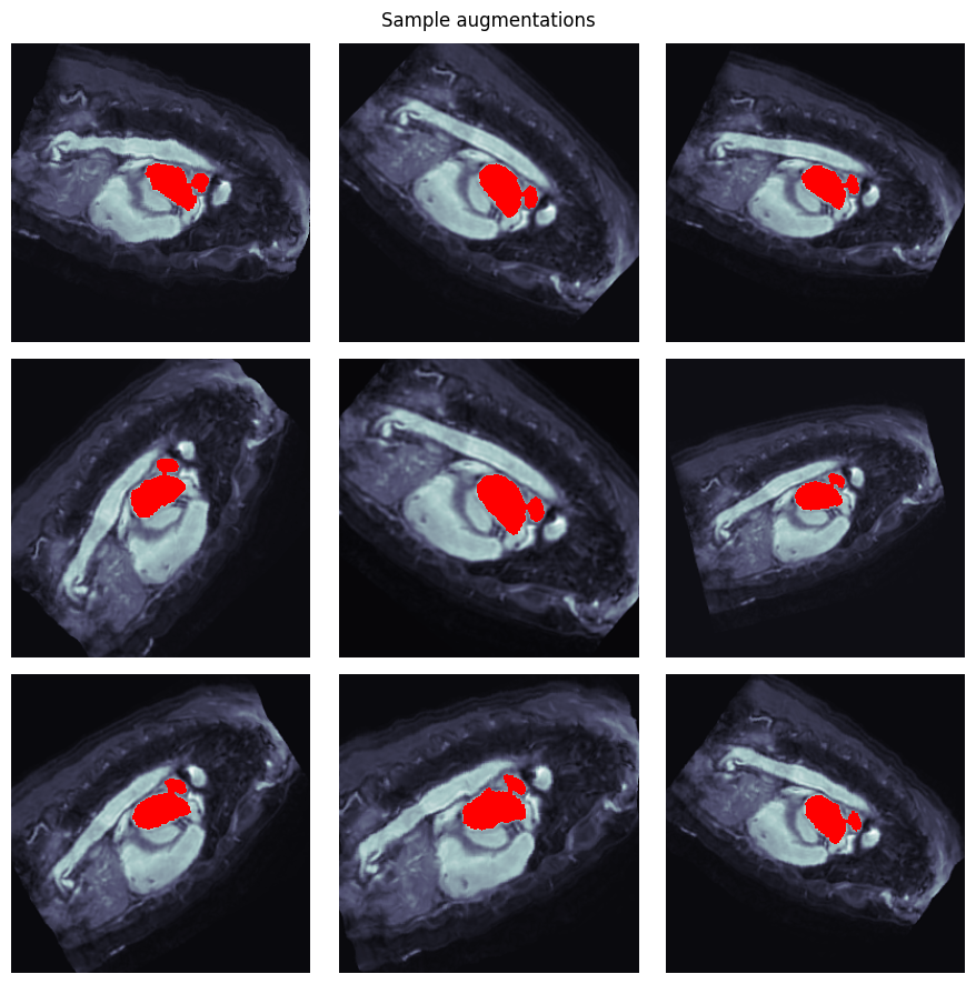 GitHub - SinghAnkit1010/Atrium-Segmentation