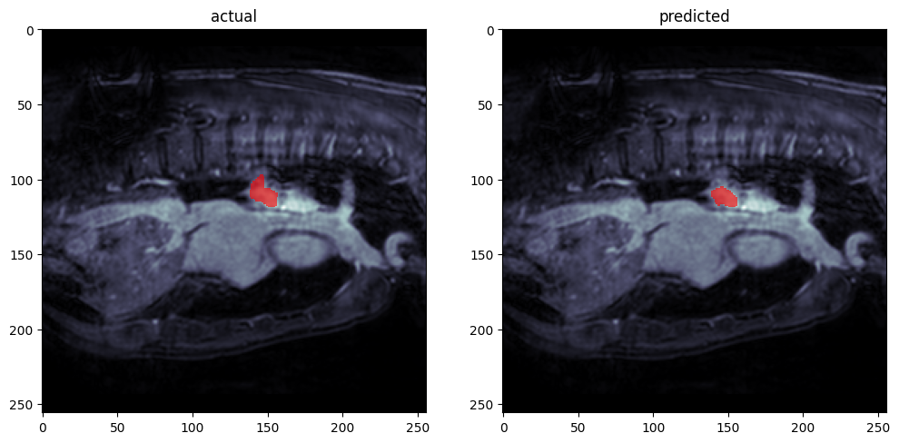 GitHub - SinghAnkit1010/Atrium-Segmentation