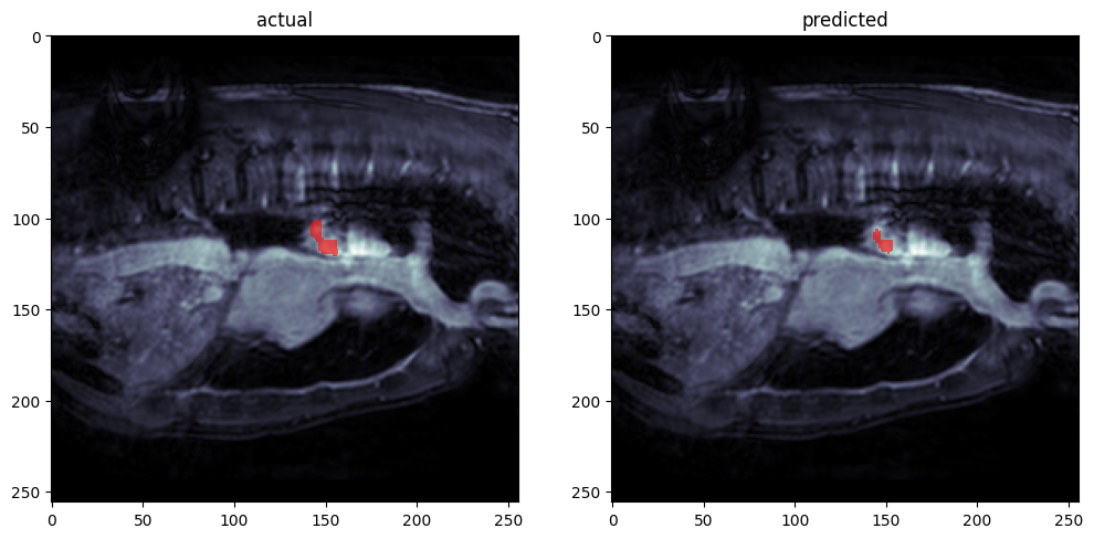 GitHub - SinghAnkit1010/Atrium-Segmentation