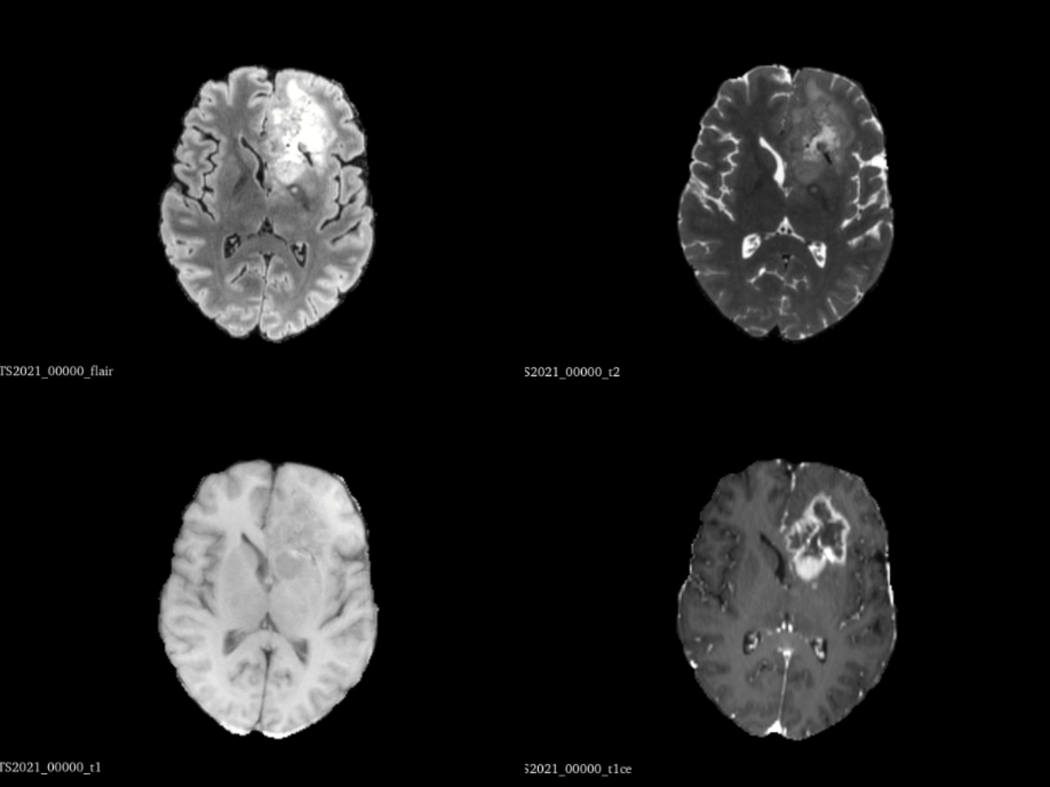 TumorImageEditor/README.md at main · Hikari0727/TumorImageEditor · GitHub