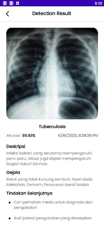 X-Detect C23-PC603 · GitHub