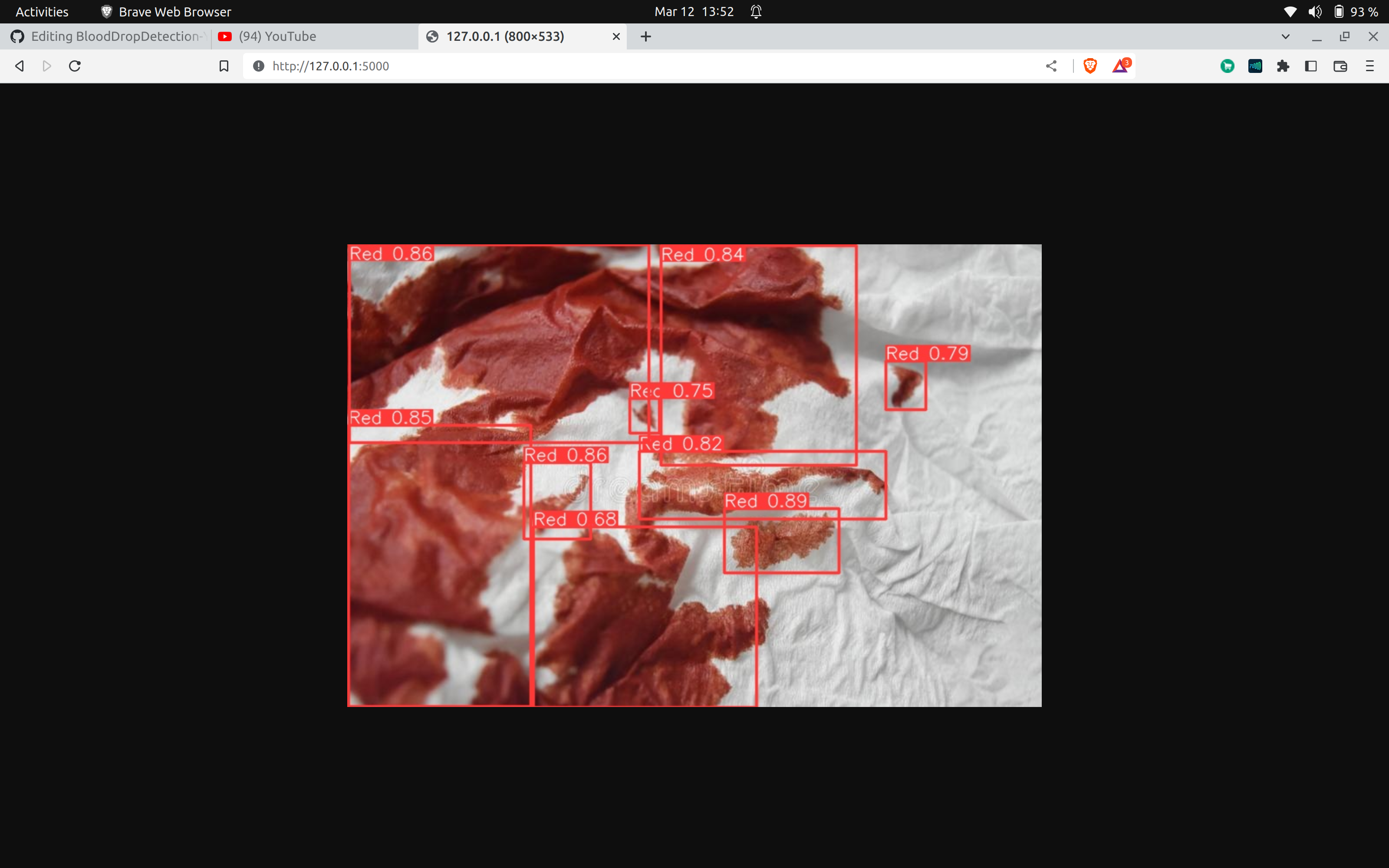 GitHub - akshaysanil/BloodDropDetection-Yolov5: Created a web ...