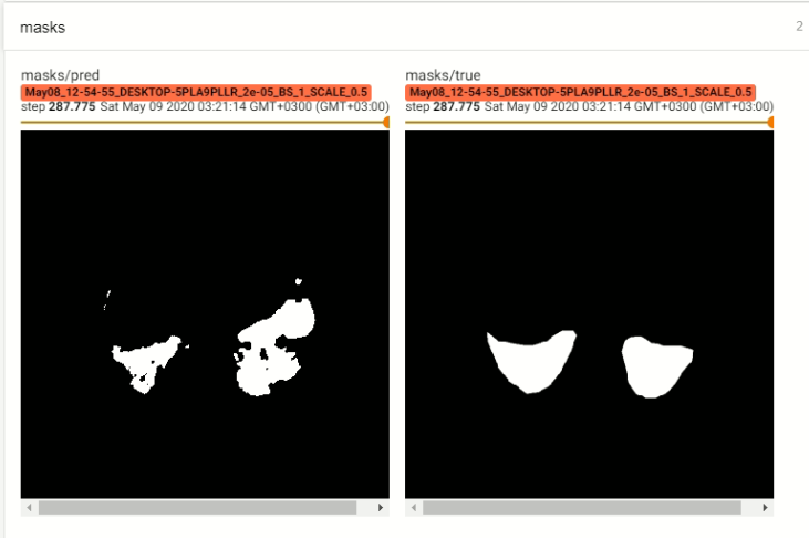 Poor performance on Pancreas dataset · Issue #175 · milesial/Pytorch-UNet · GitHub