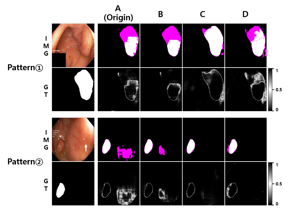 GitHub - ggomaeng514/Attention-with-semantic_segmentation
