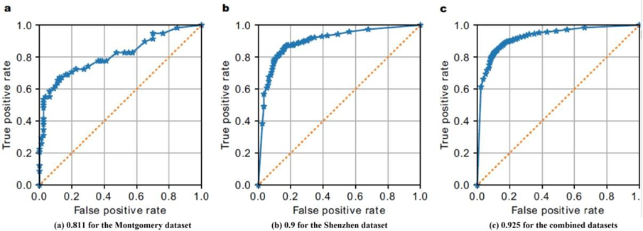Github Saleem Saleem Using Deep Neural Networks For Tuberculosis Detection Chest X Ray Images