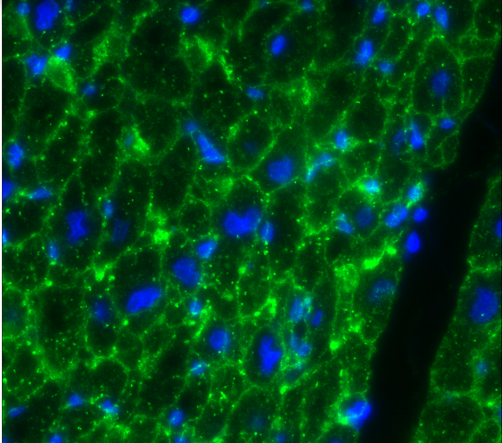 Heterogeneous cells and diameter choice · Issue #700 · MouseLand ...