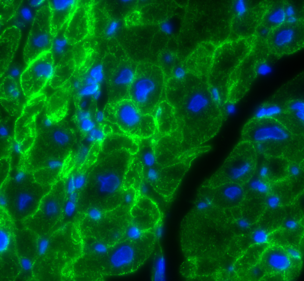 Heterogeneous cells and diameter choice · Issue #700 · MouseLand ...