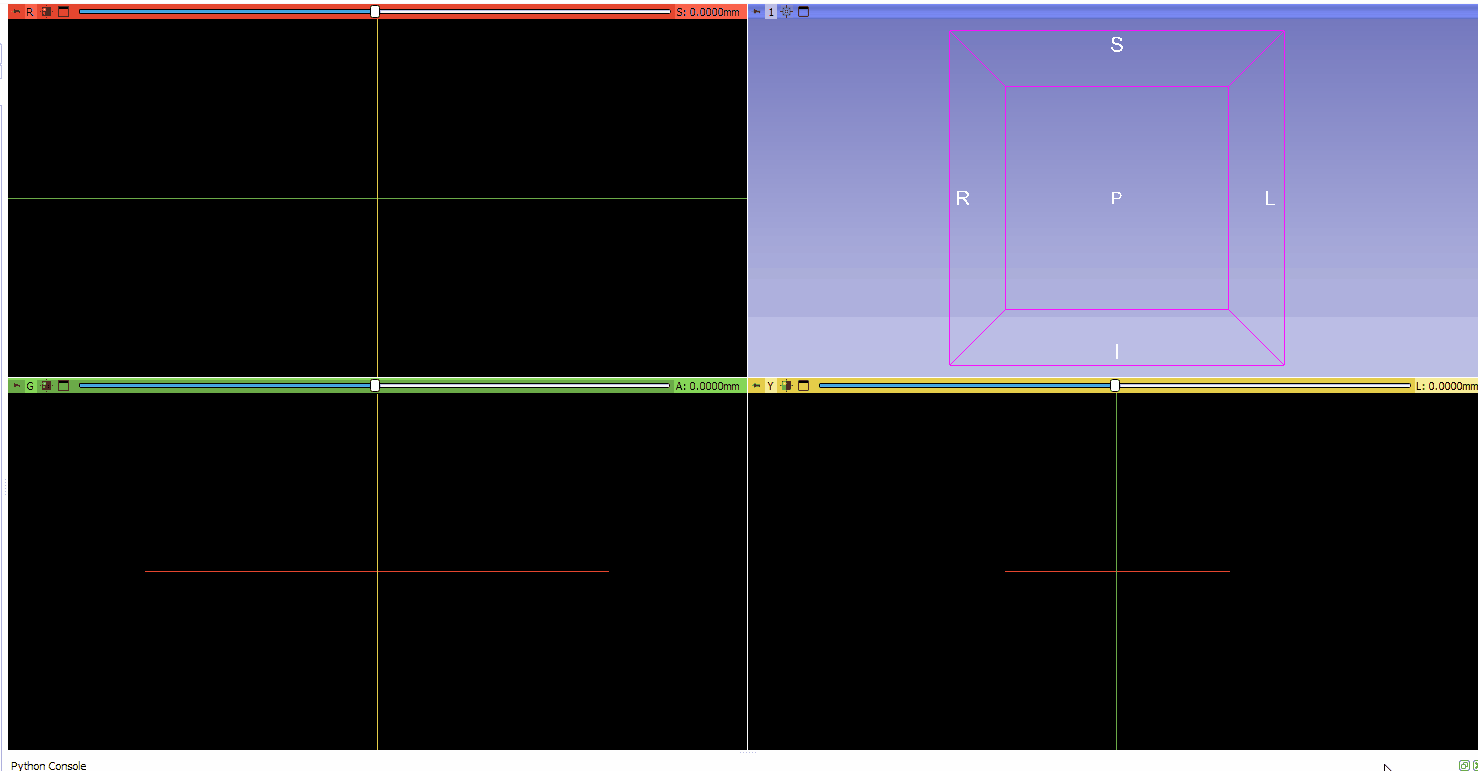 Restore View Layout Has No Affect · Issue 7095 · Slicerslicer · Github 