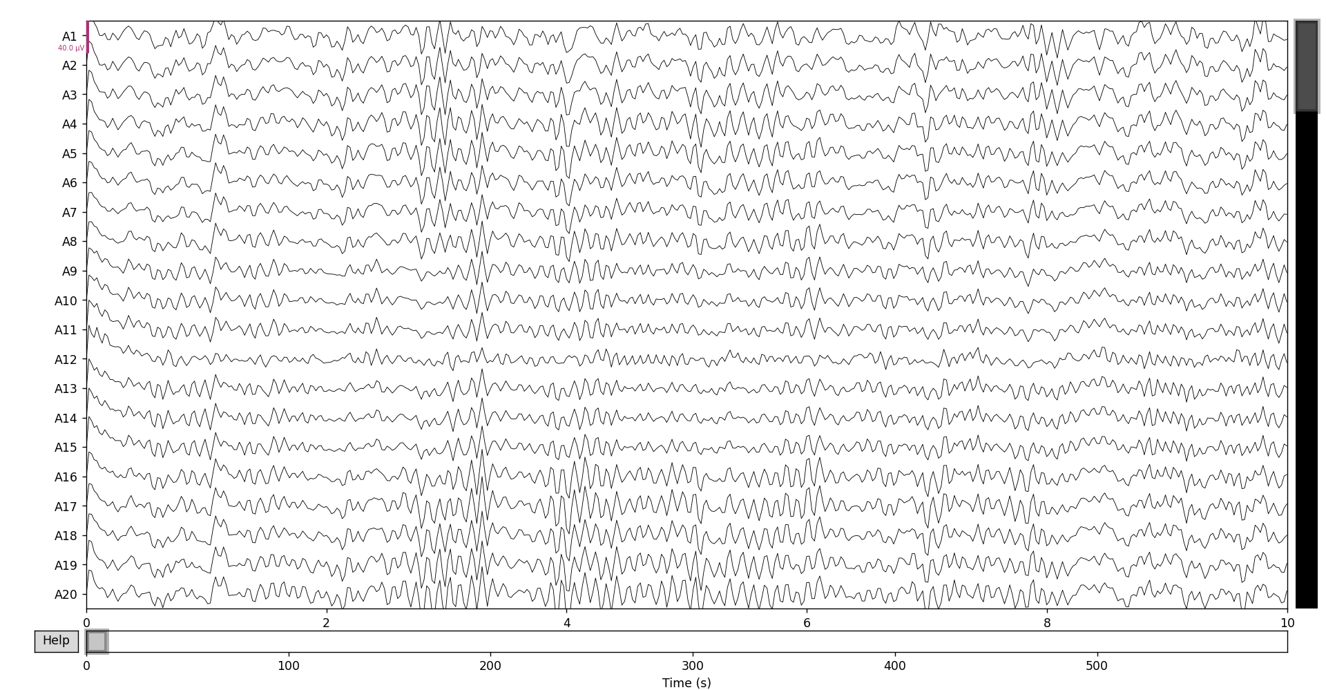 GitHub - pedrobenedetti/EEG_Biosemi