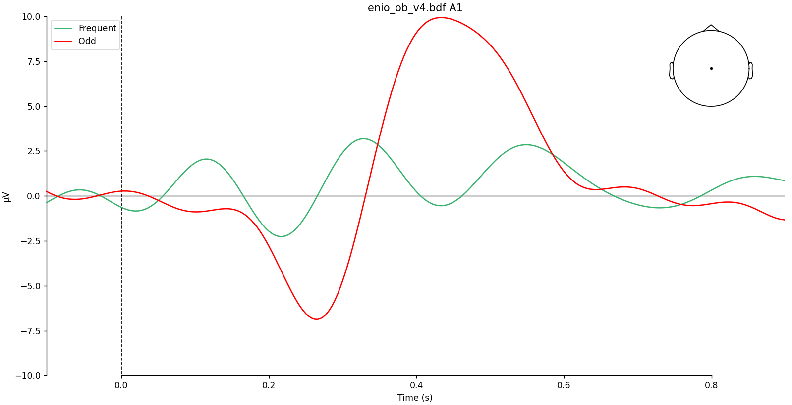 GitHub - pedrobenedetti/EEG_Biosemi